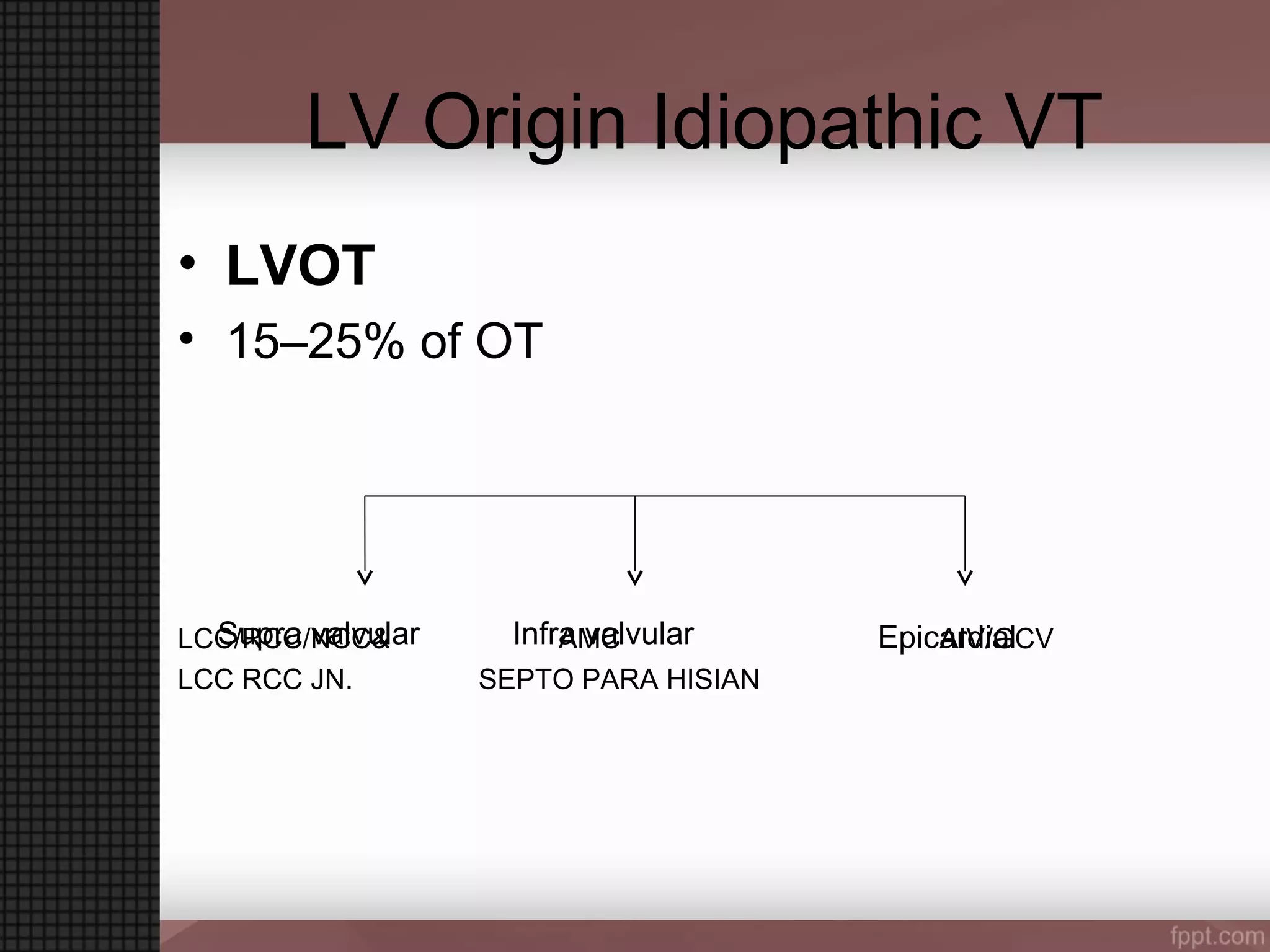 ventricular tachycardia (VT) Localisation | PPT
