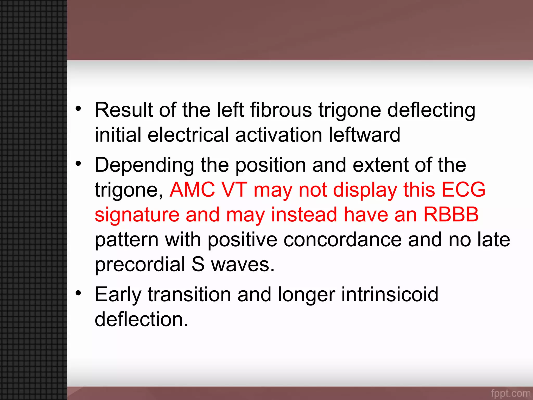 ventricular tachycardia (VT) Localisation | PPT