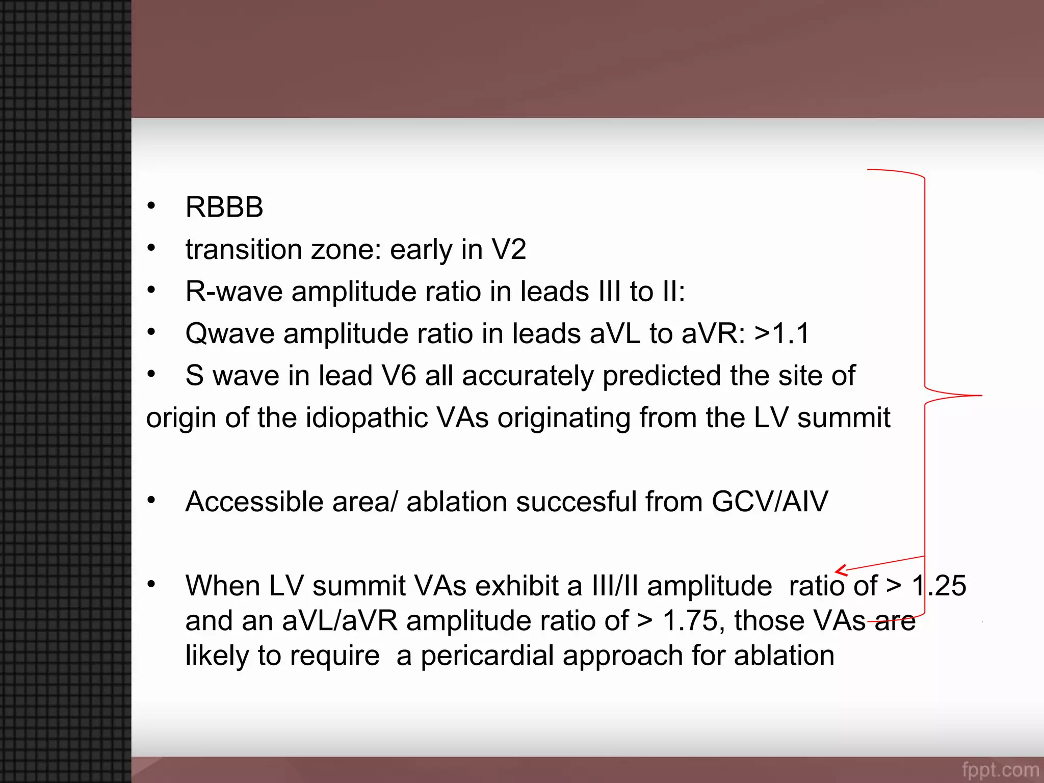 ventricular tachycardia (VT) Localisation | PPT