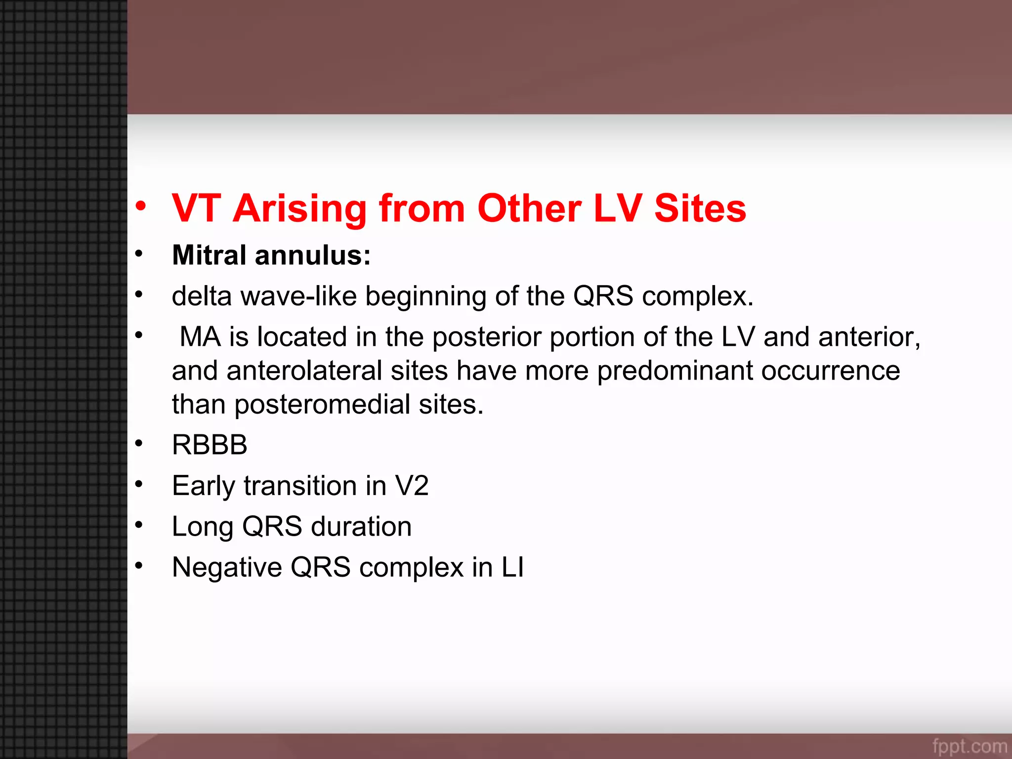 ventricular tachycardia (VT) Localisation | PPT