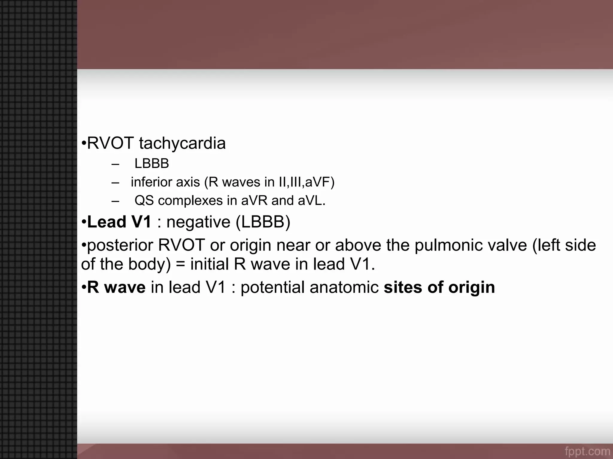 ventricular tachycardia (VT) Localisation | PPT