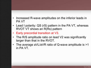 ventricular tachycardia (VT) Localisation | PPT
