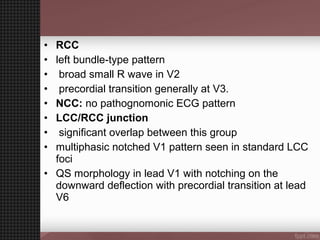 ventricular tachycardia (VT) Localisation | PPT