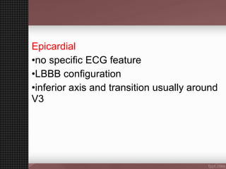 ventricular tachycardia (VT) Localisation | PPT
