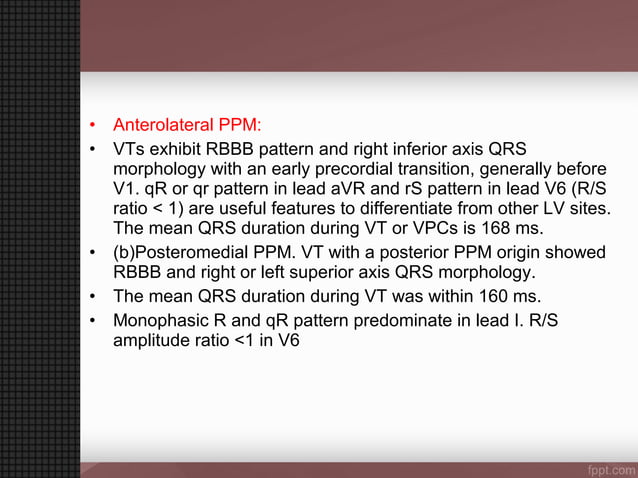 ventricular tachycardia (VT) Localisation | PPT