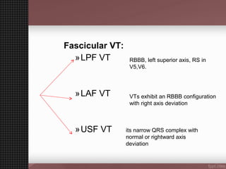 ventricular tachycardia (VT) Localisation | PPT