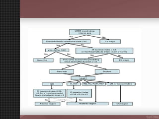 ventricular tachycardia (VT) Localisation | PPT