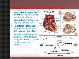 ventricular tachycardia (VT) Localisation | PPT