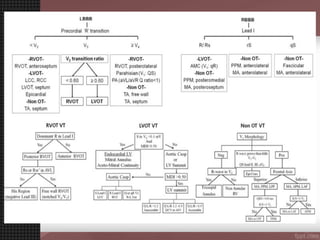 ventricular tachycardia (VT) Localisation | PPT