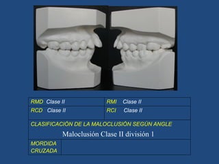 VTO DENTARIO ORTODONCIA 2025 DIAPOSITIVA | PPTX