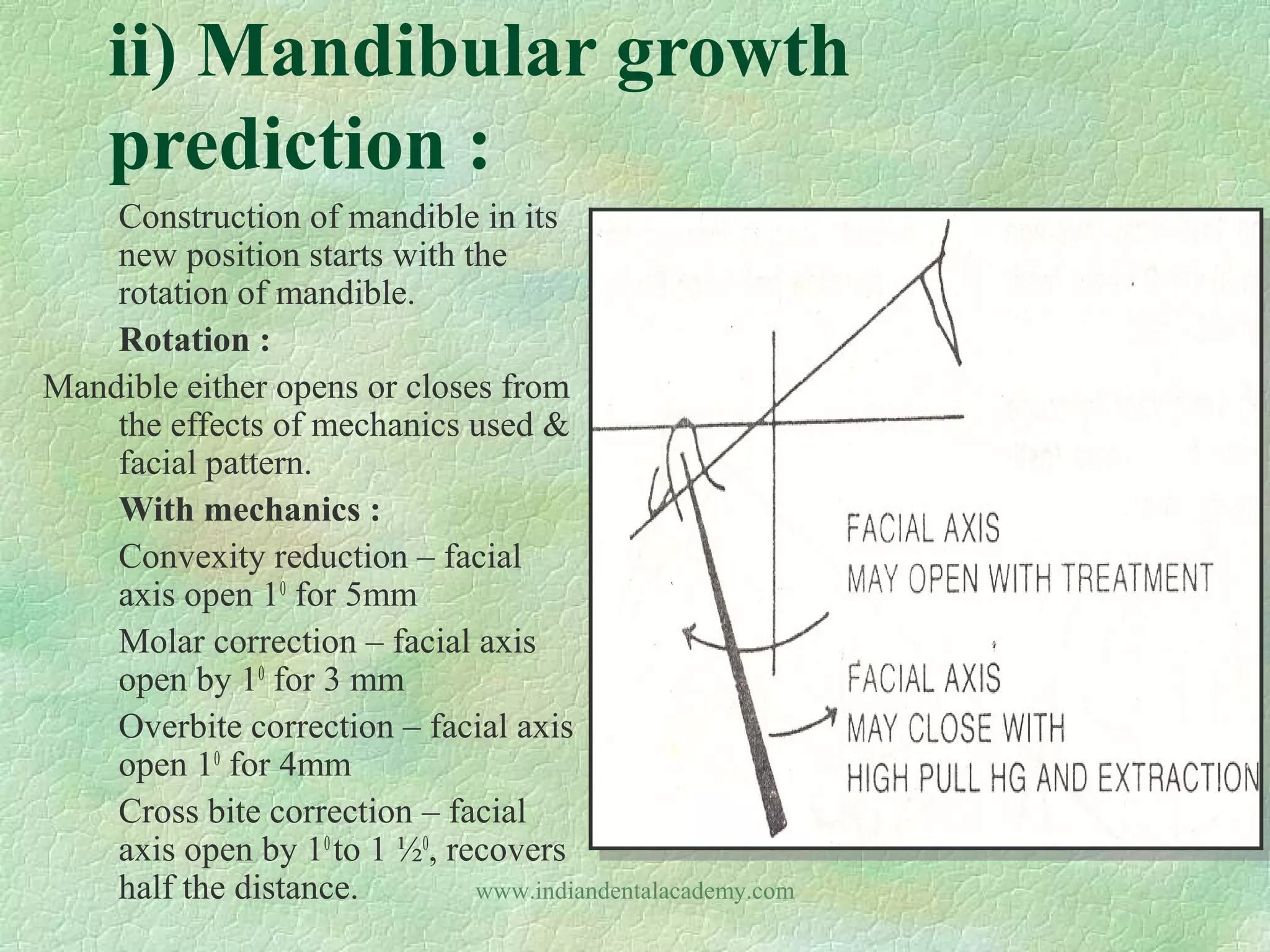 VTO (visualised Treatment objective) | PPT