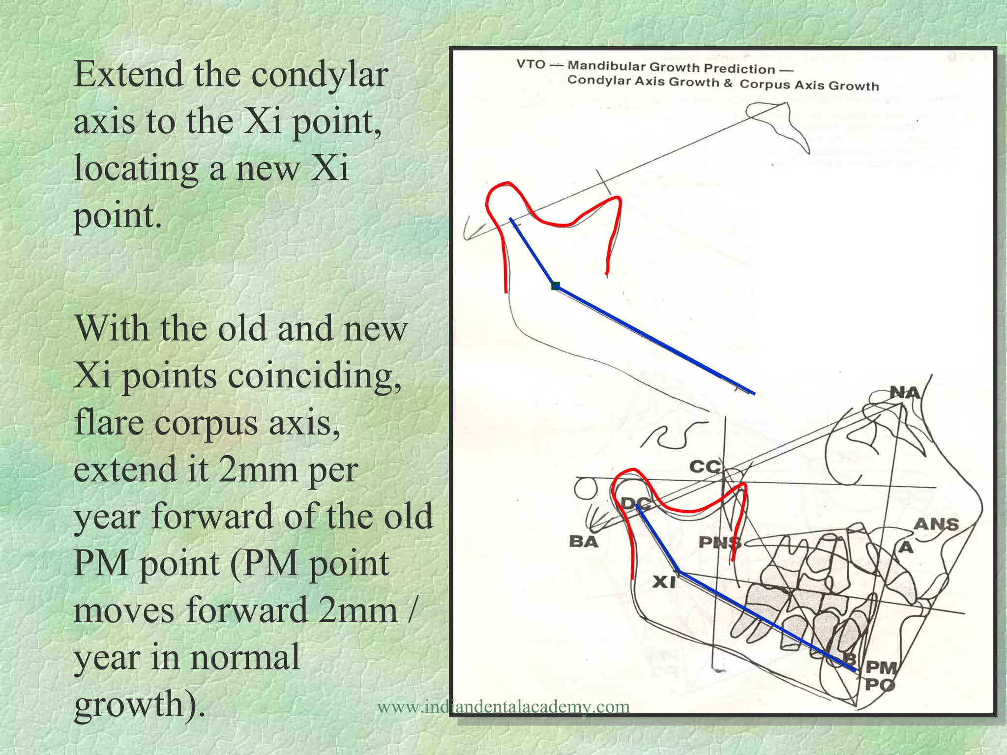 VTO (visualised Treatment objective) | PPT