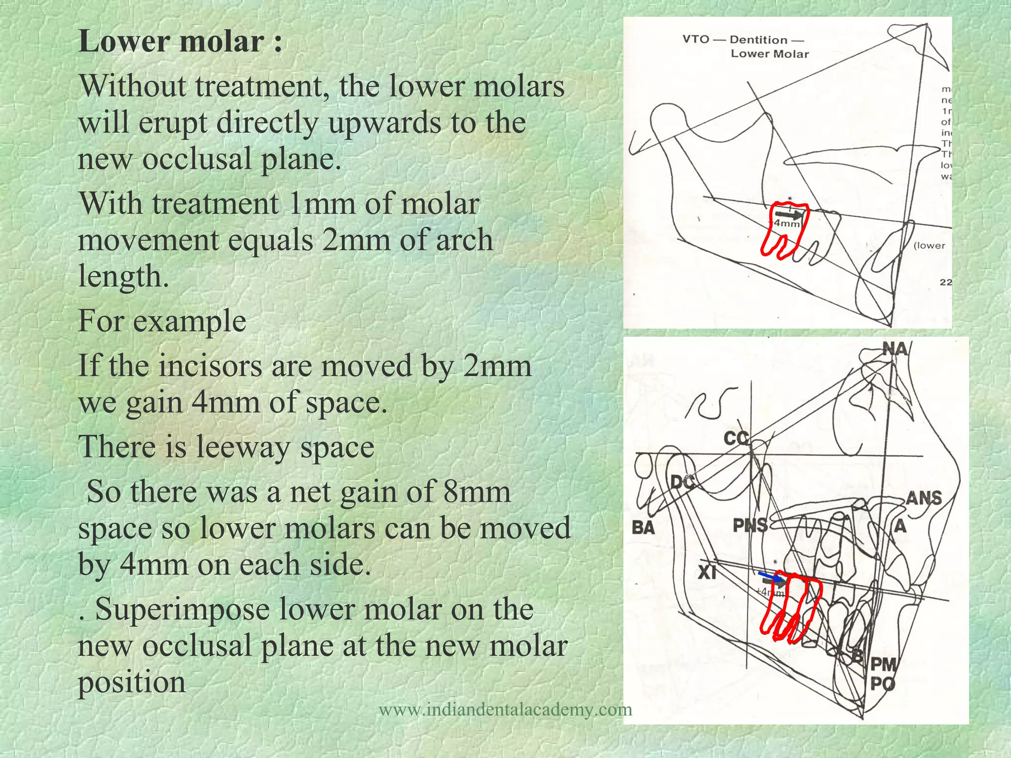 VTO (visualised Treatment objective) | PPT