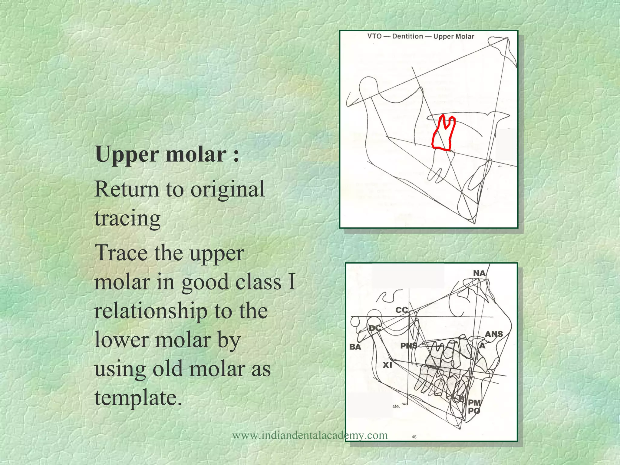 VTO (visualised Treatment objective) | PPT
