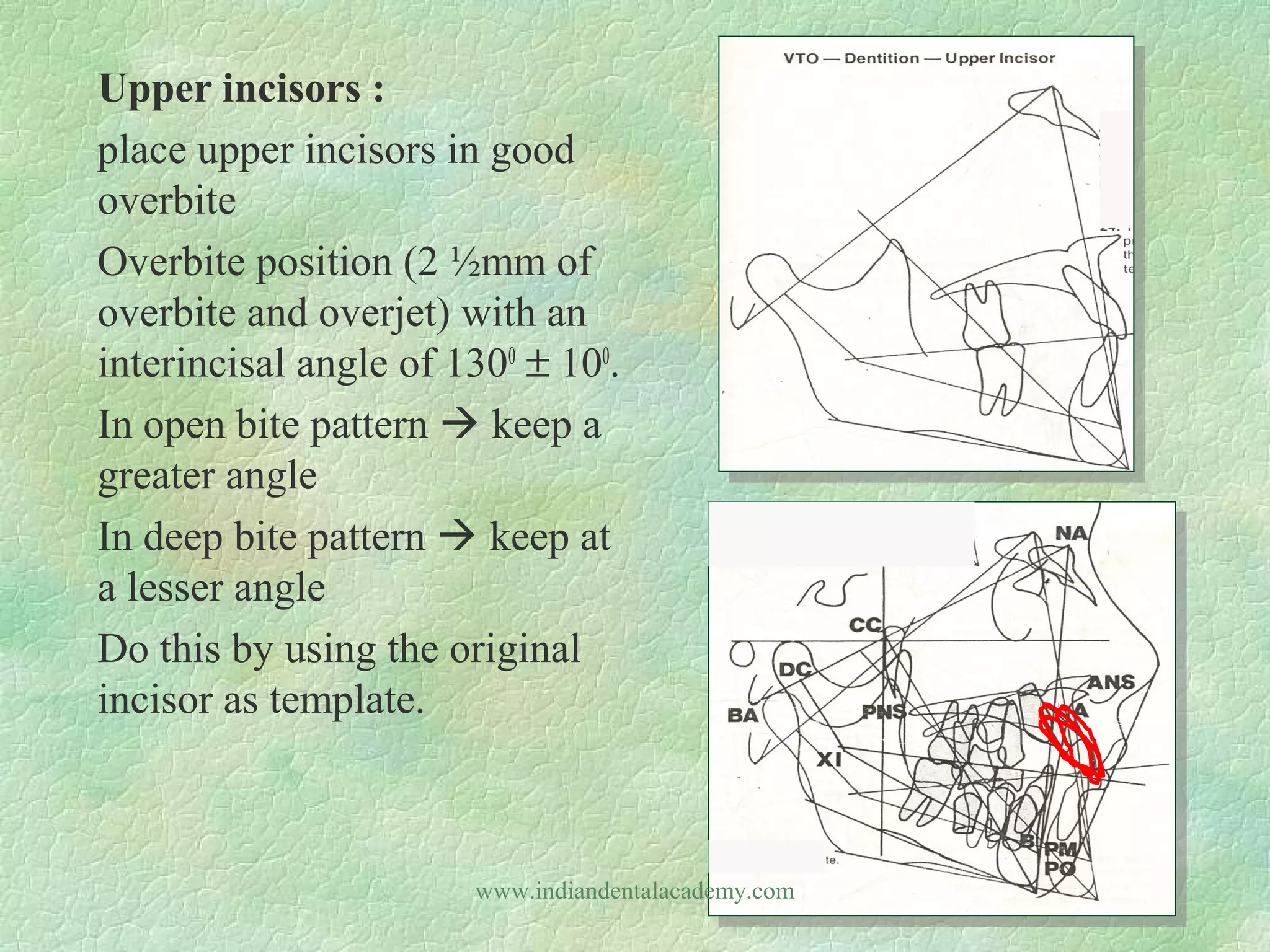 VTO (visualised Treatment objective) | PPT