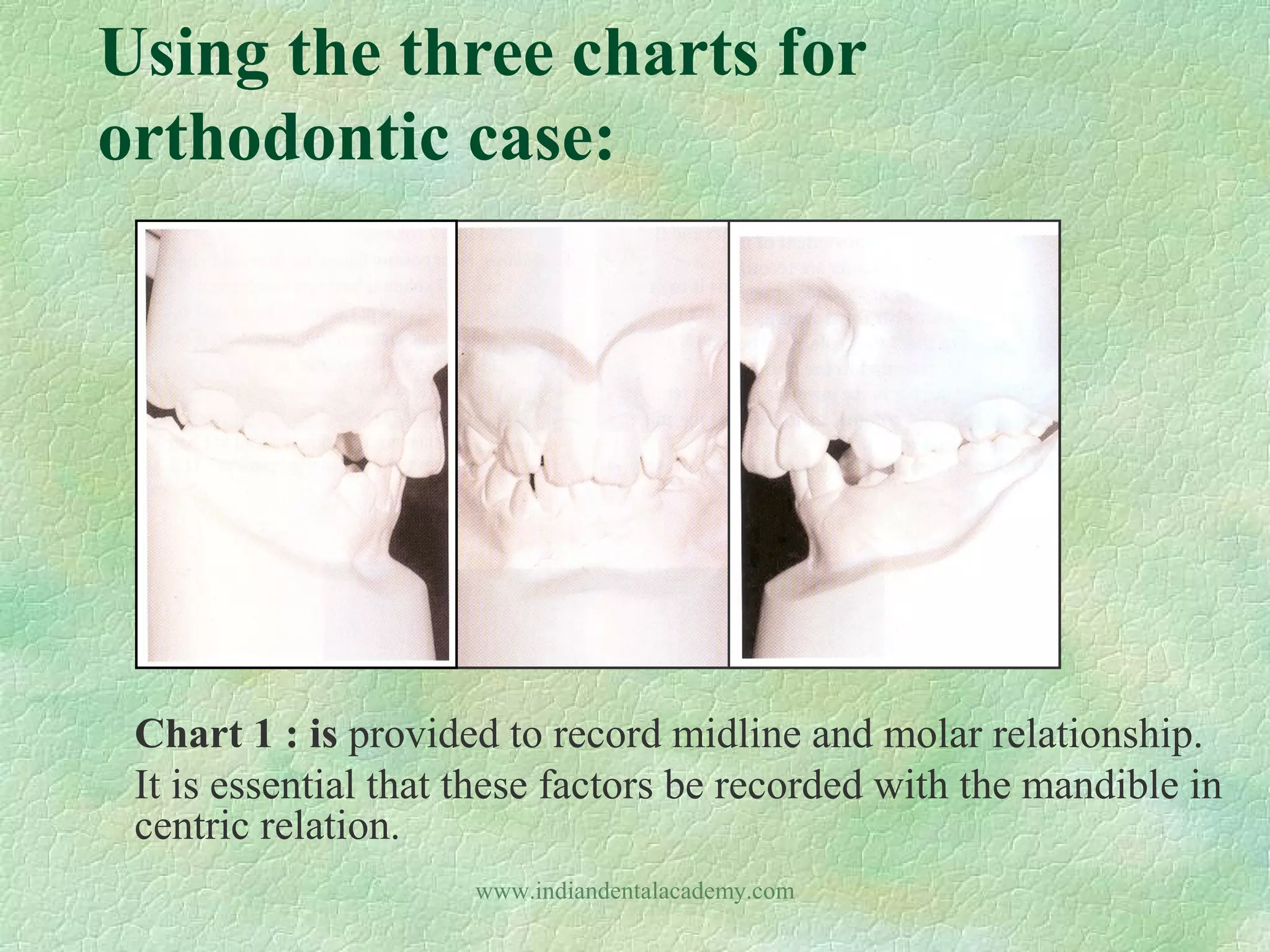 VTO (visualised Treatment objective) | PPT