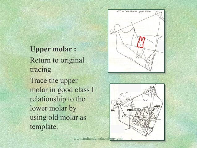 VTO (visualised Treatment objective) | PPT | Dental Health | Diseases ...