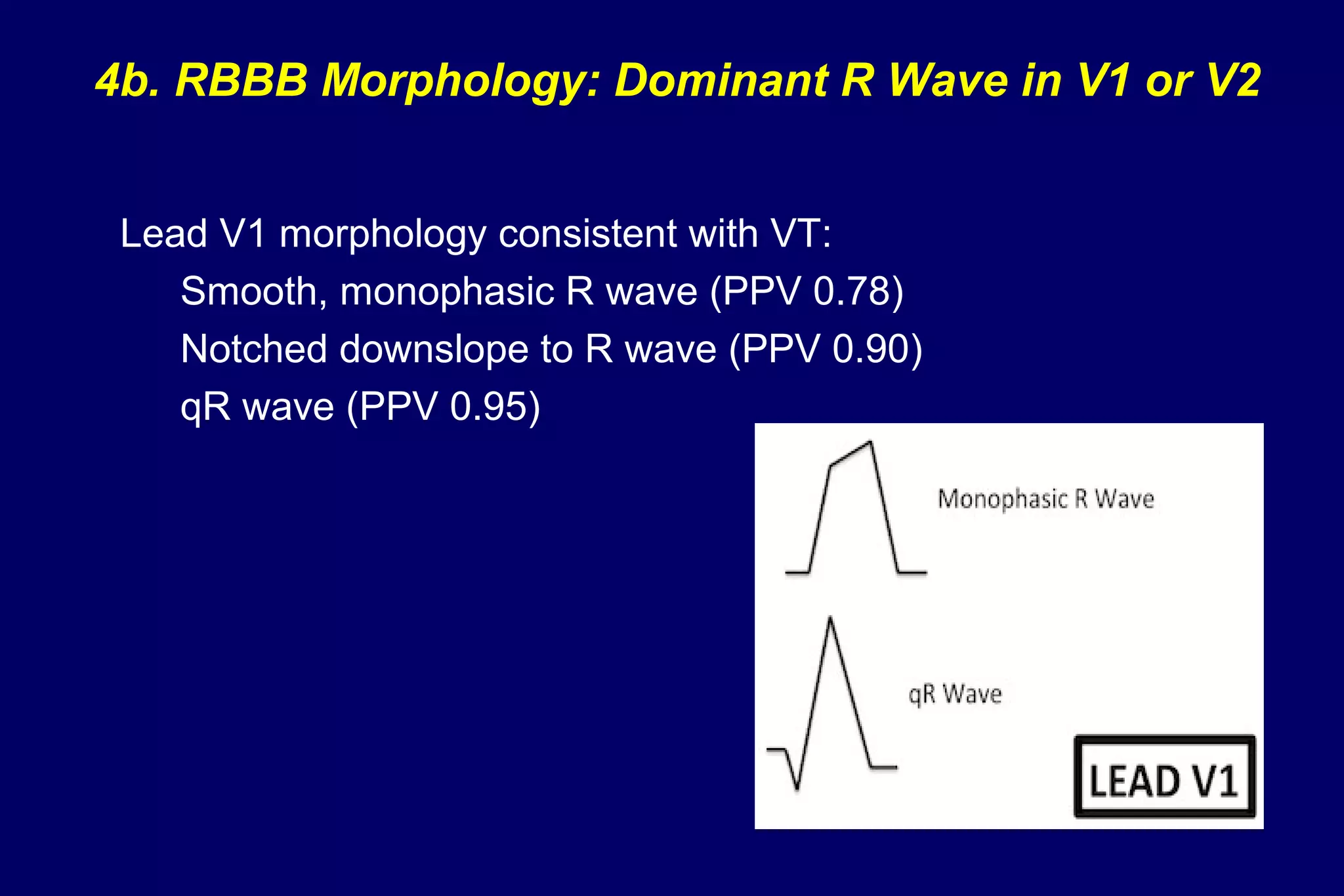 Vt vs svt ab copy | PPT