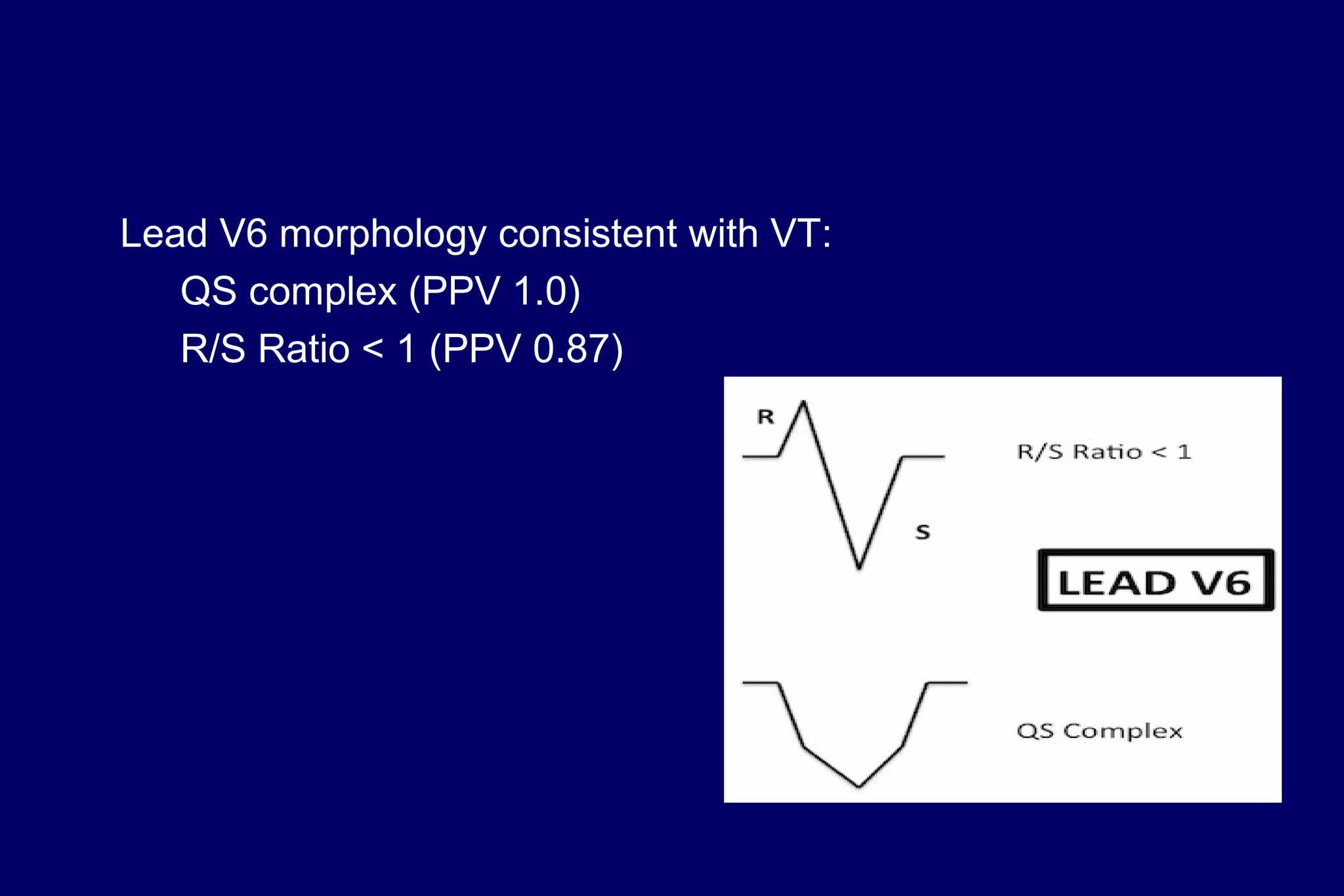 Vt vs svt ab copy | PPT