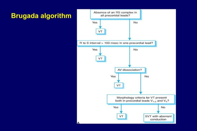 Vt vs svt ab copy | PPT | Heart and Cardiovascular Diseases | Diseases ...