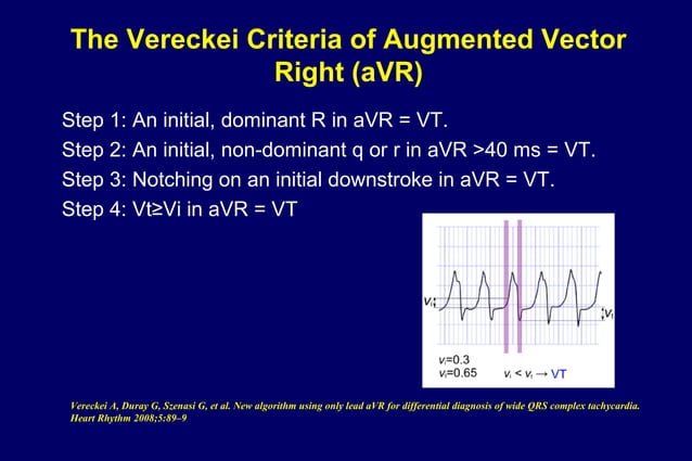 Vt vs svt ab copy | PPT | Heart and Cardiovascular Diseases | Diseases ...