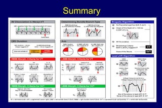 Ventricular Tachycardia Vs Supraventricular Tachycardia