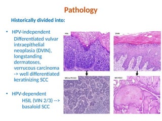 vulva.pptx radiation oncology ppt radiation | PPTX