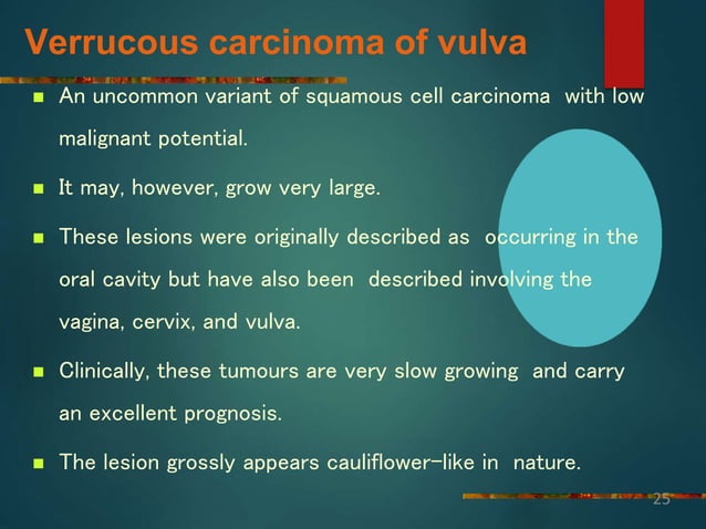 Vulval Cancer Diagnosis and Staging | PPTX | Cancer | Diseases and ...