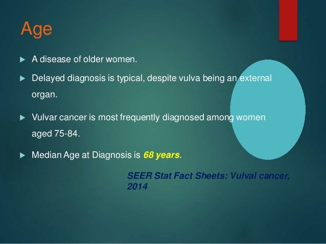 Vulva Cancer Cancerindex