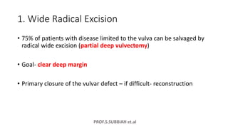 Vulval cancer evolution of management | PPTX