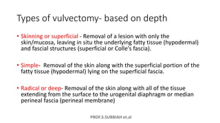 Vulval cancer evolution of management | PPT