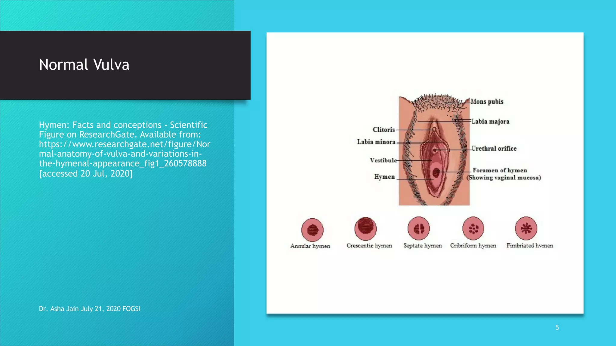 Vulval Disorders and Their Management | PPT
