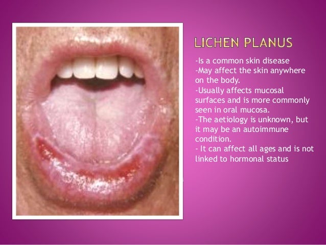 Vulval Skin Disorders