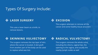 VULVAR CANCER - NORTH TEXAS GYNECOLOGIC ONCOLOGY | PPT