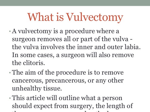 Vulvectomy | PPTX