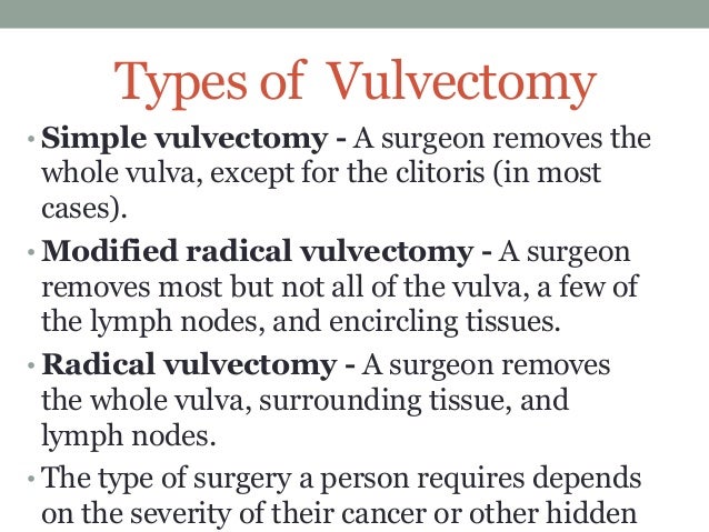 Vulvectomy | PPTX