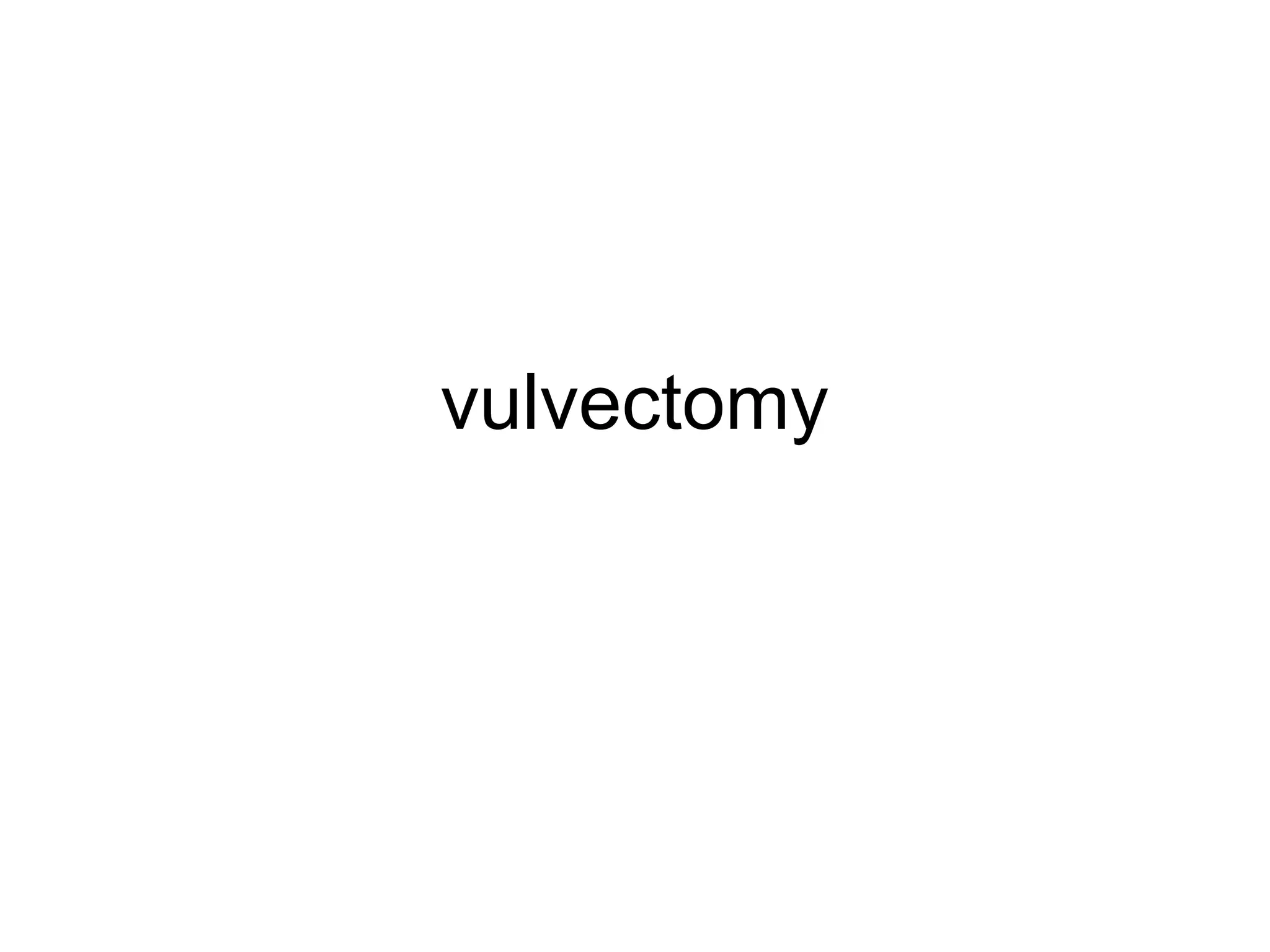 vulvectomy.ppt, a surgical procedure to remove the vulva | PPT