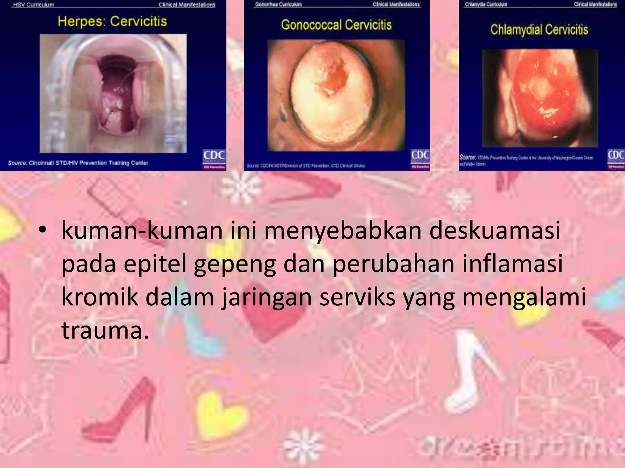 Vulvitis & servisitis | PPTX