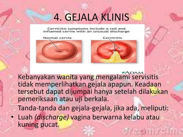 Vulvitis & servisitis | PPTX