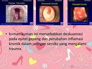 Vulvitis & servisitis | PPTX