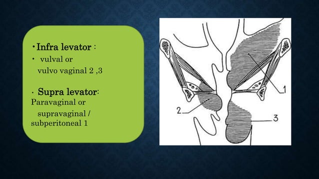 Vulvovaginal hematoma - Dr Mitra Saxena | PPTX