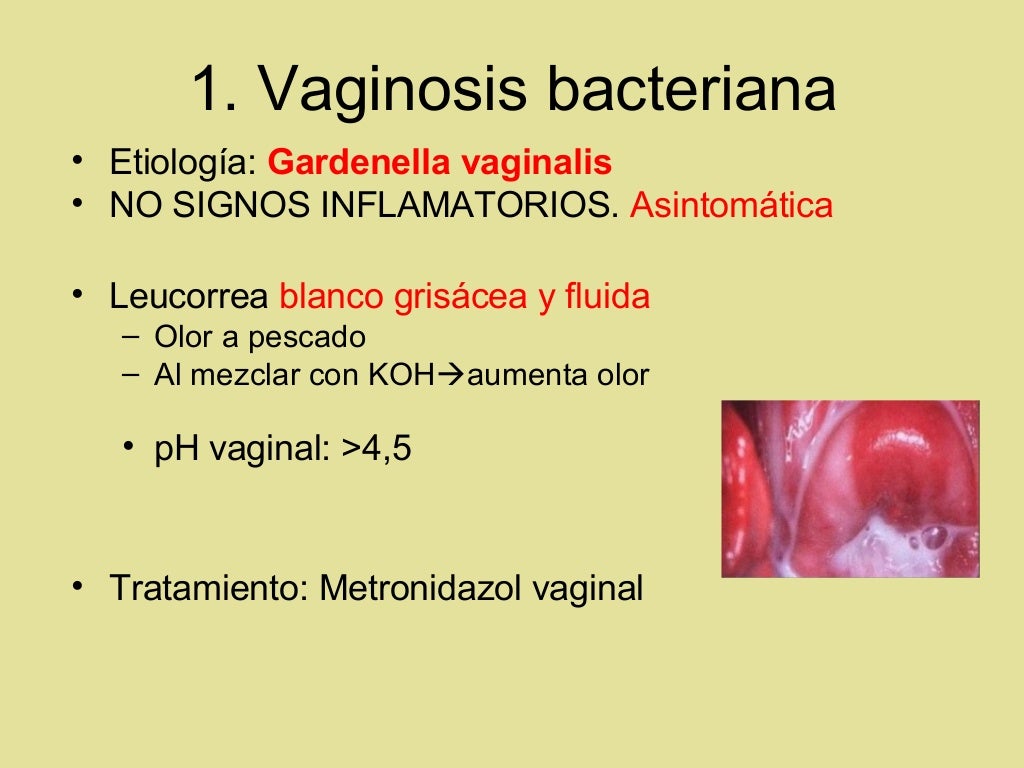 Vulvovaginitis