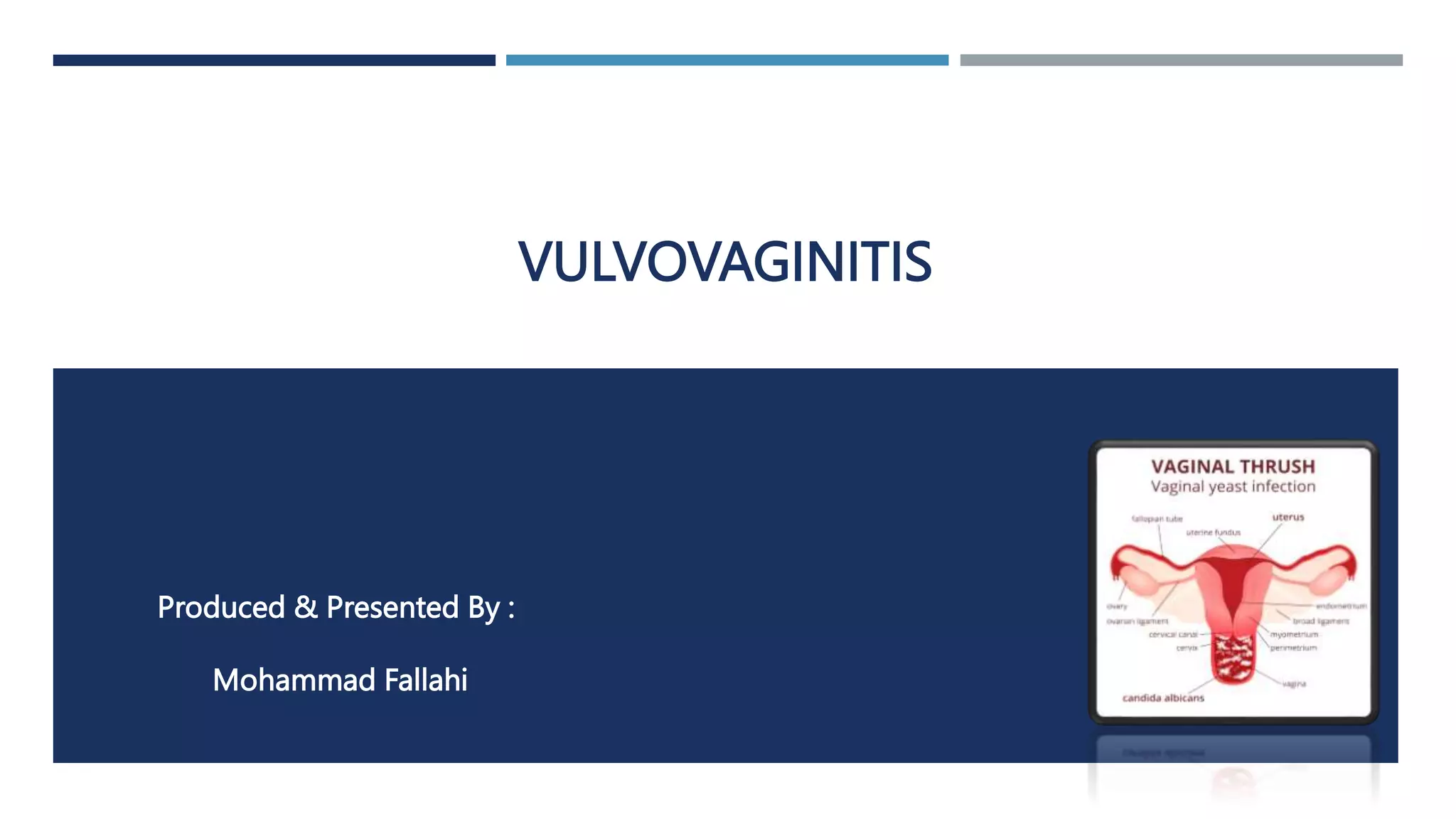 VULVOVAGINITIS - Presentation.pptx