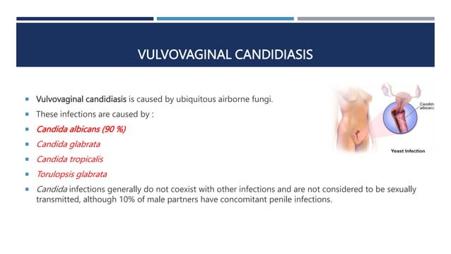 VULVOVAGINITIS - Presentation.pptx