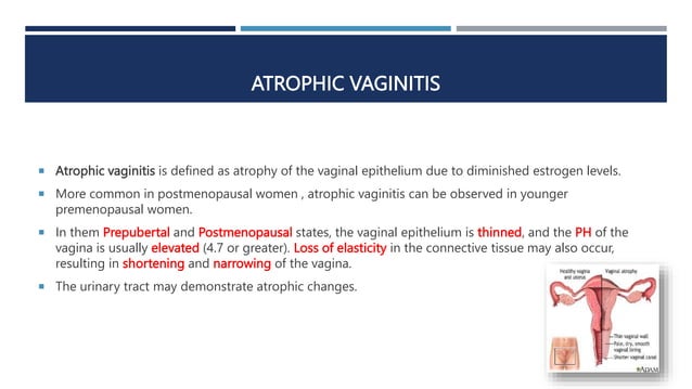 VULVOVAGINITIS - Presentation.pptx