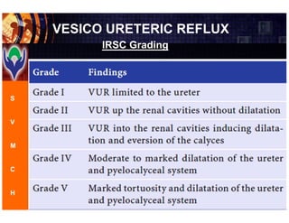 Vesicoureteric Reflux- commonest cause for pediatric UTI | PDF