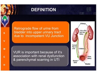 Vesicoureteric Reflux- commonest cause for pediatric UTI | PDF