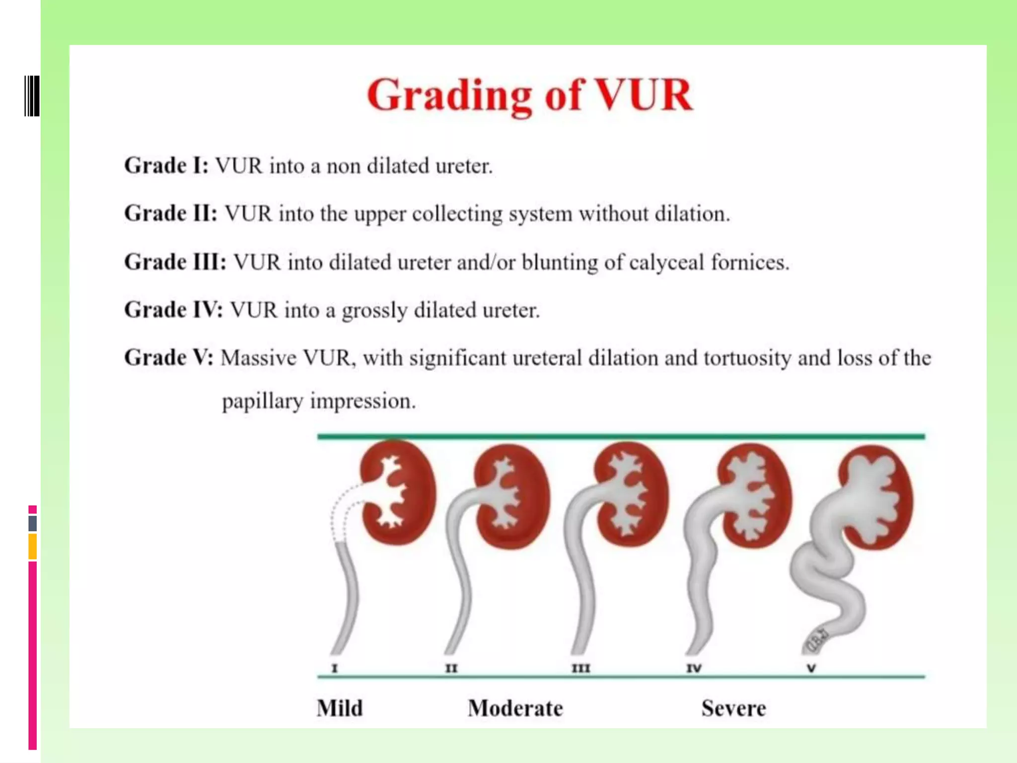 VUR & Reflux Nephropathy.pptx