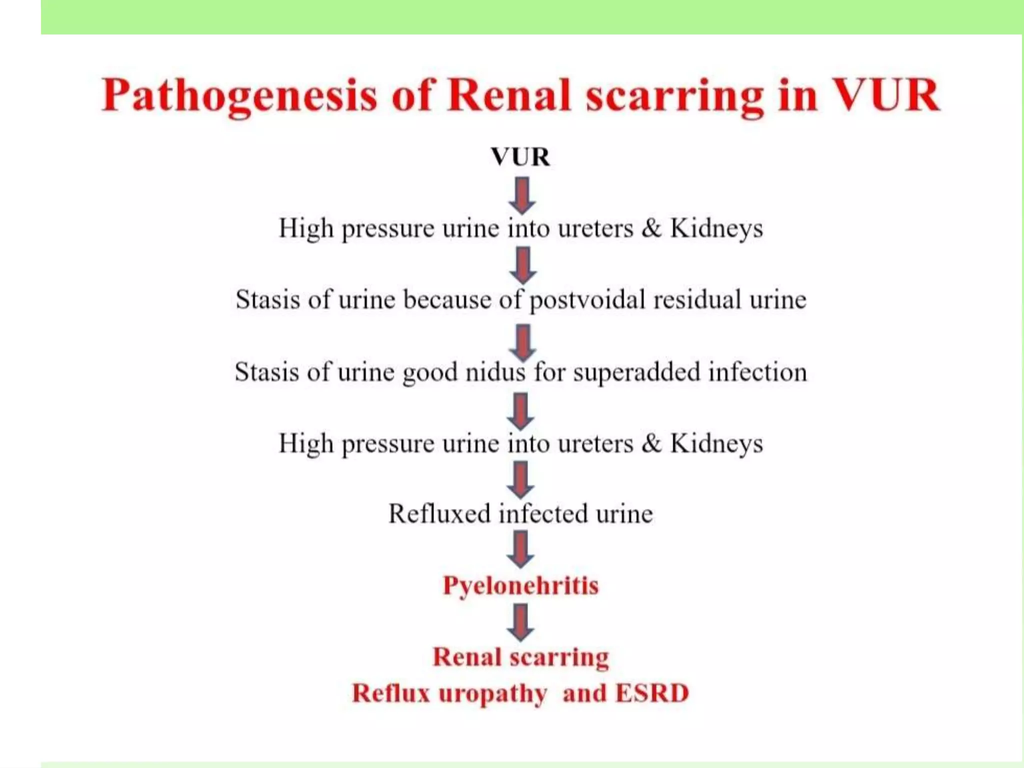 VUR & Reflux Nephropathy.pptx