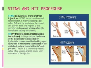 VUR & Reflux Nephropathy.pptx